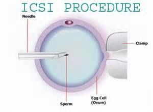ICSI - a threat or a blessing? - News - Hippomundo